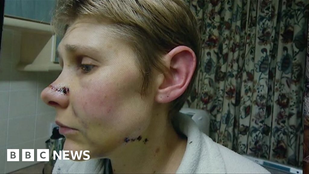 Stalking victim Helen Pearson rejects police apology over stabbing