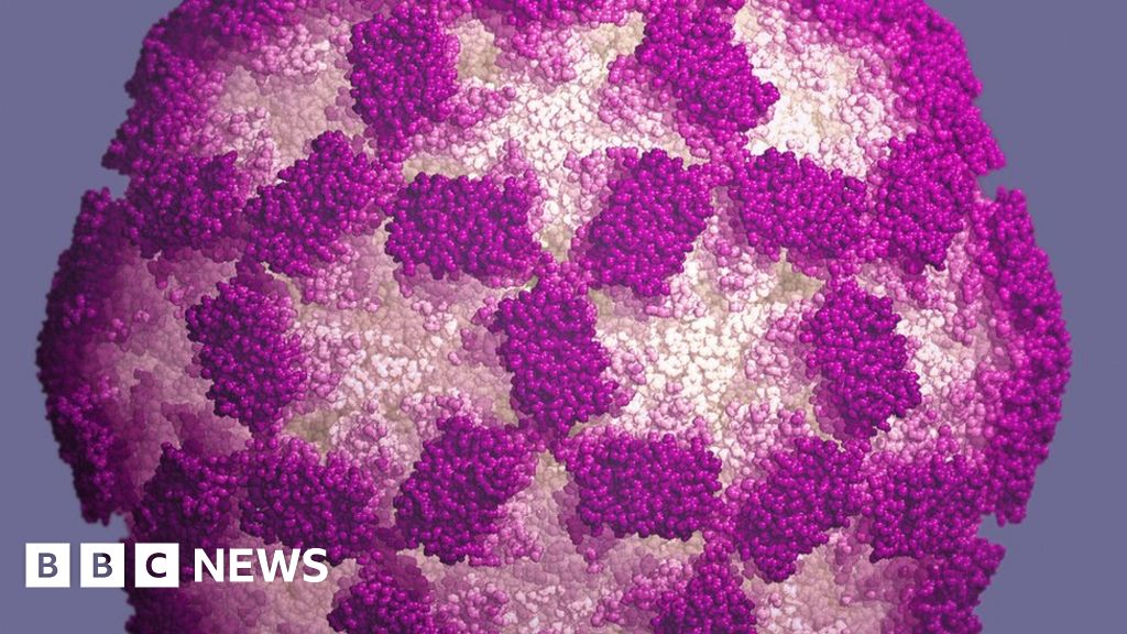 Royal Bolton Hospital: Norovirus outbreak prompts visitor ban