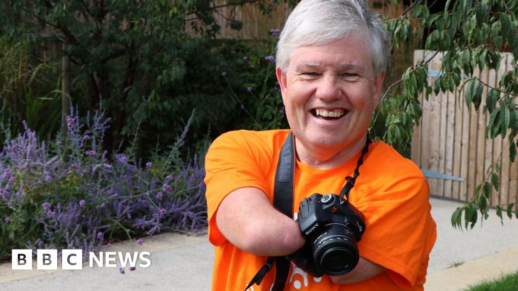 Oxfordshire man born without limbs wins fundraiser award - BBC News