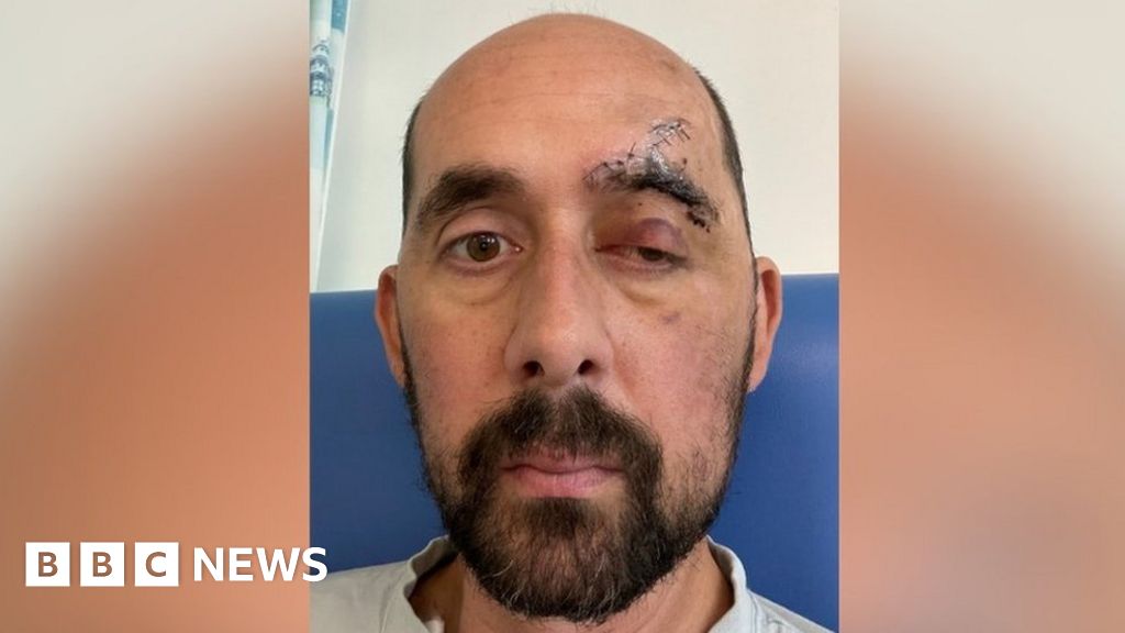 Homeowner prosecuted after wall collapse injures builder