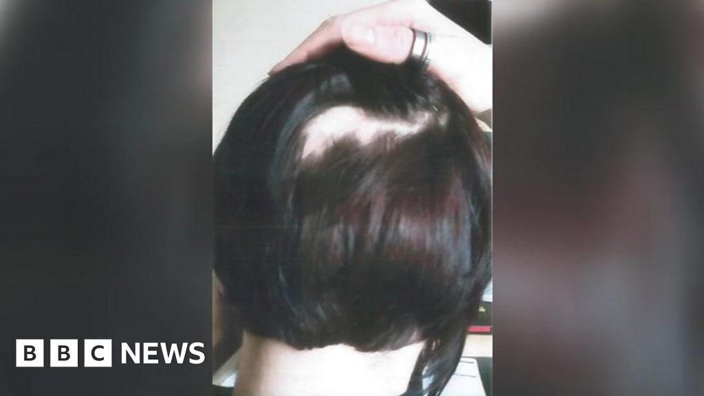 West Midlands Police officer's hair ripped out by attacker - BBC News