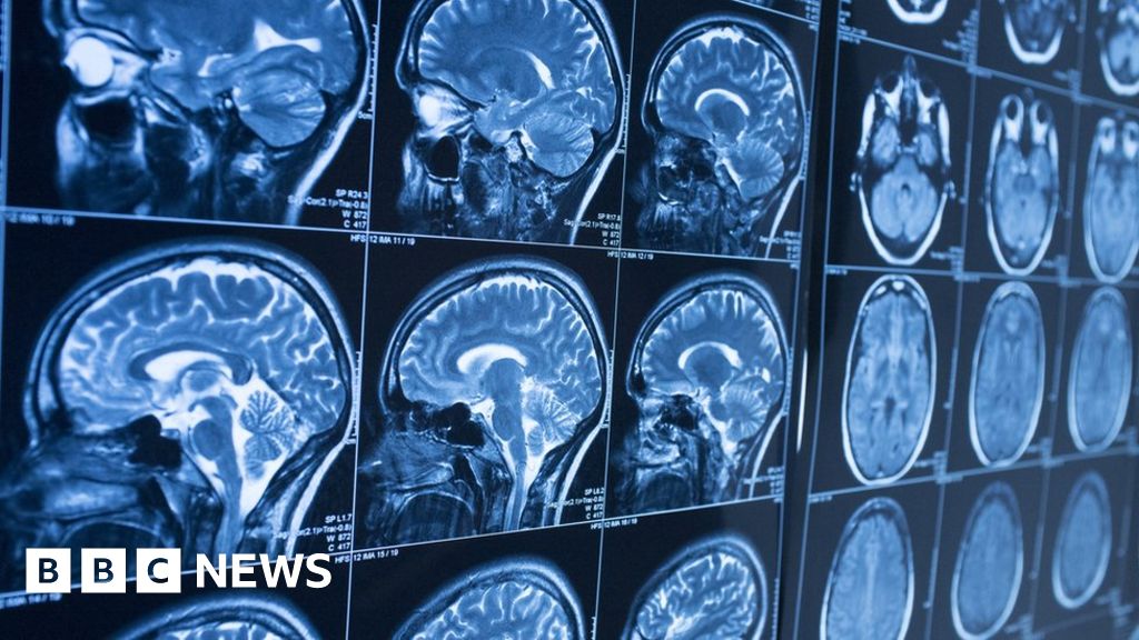 MRI scan delays causing East Midlands patients 'distress' - BBC News