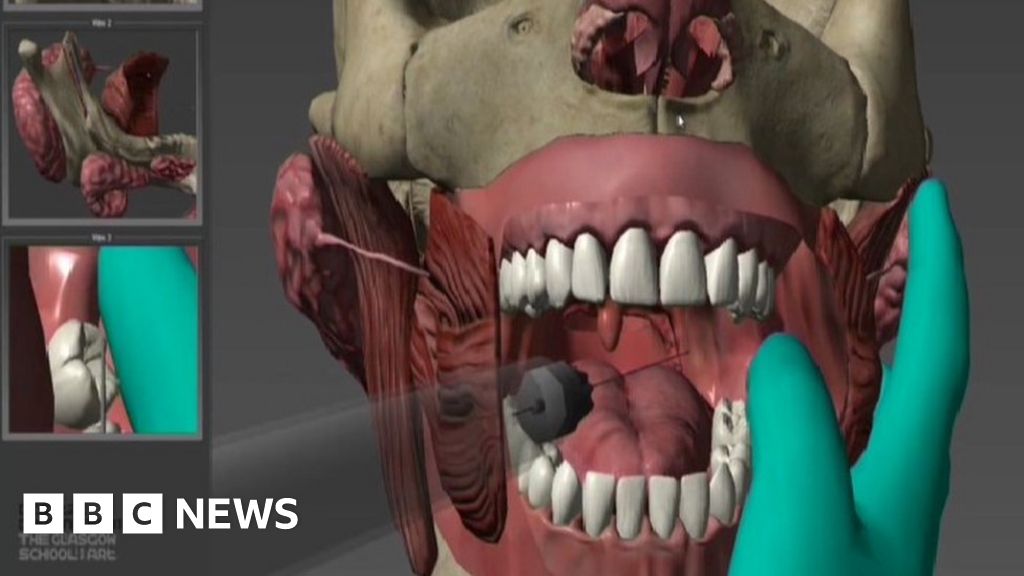 New 3D skeleton 'to transform' medical training - BBC News