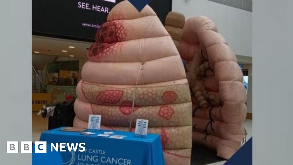 Inflatable 'mega lungs' promote cancer screening in Cambridge