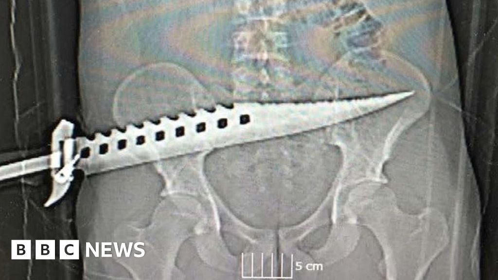 Teen jailed for stabbing victim's buttock