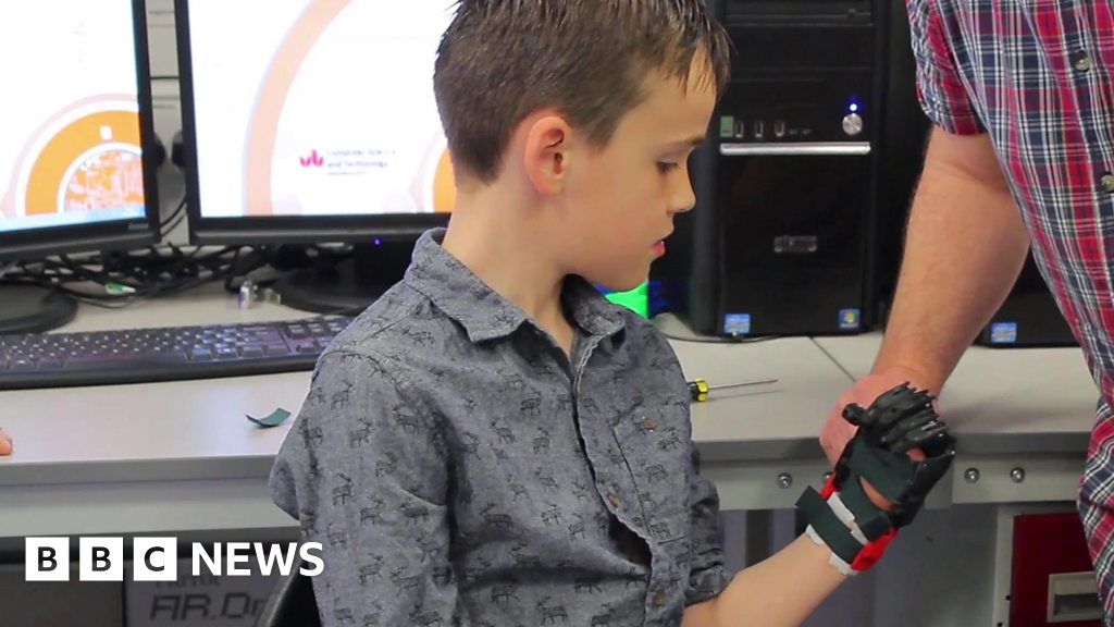 3D printed hand adapted for eight-year-old boy born with no fingers ...