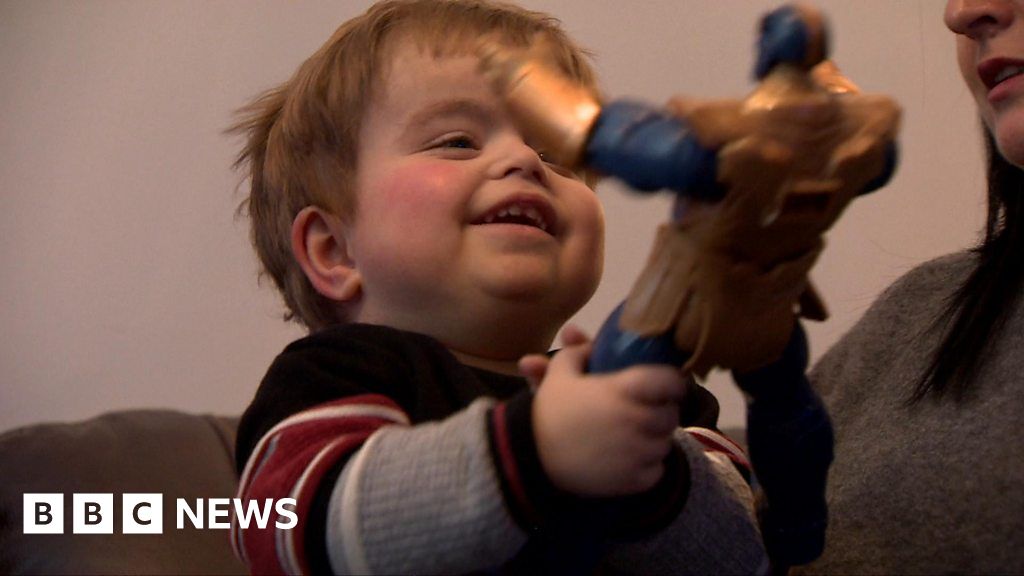 Smallest kidney transplant patient to have a different Christmas - BBC News