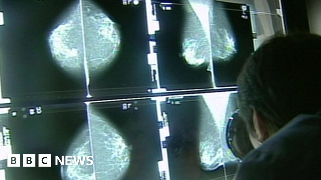 Cancers deaths 'down 10% in 10 years' - Cancer Research UK - BBC News