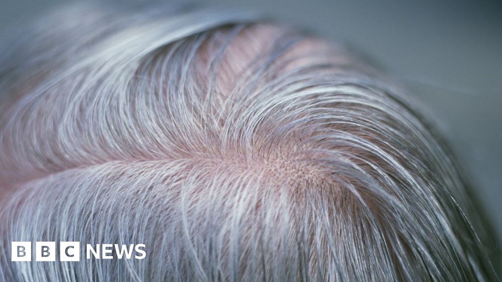 Grey hair gene discovered by scientists - BBC News