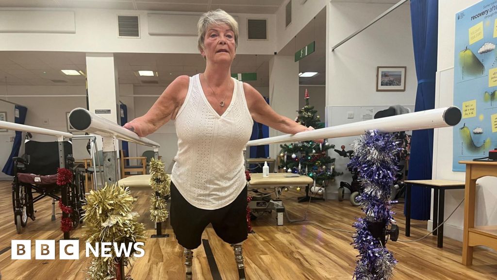 Amputee defies doctors by walking after five years