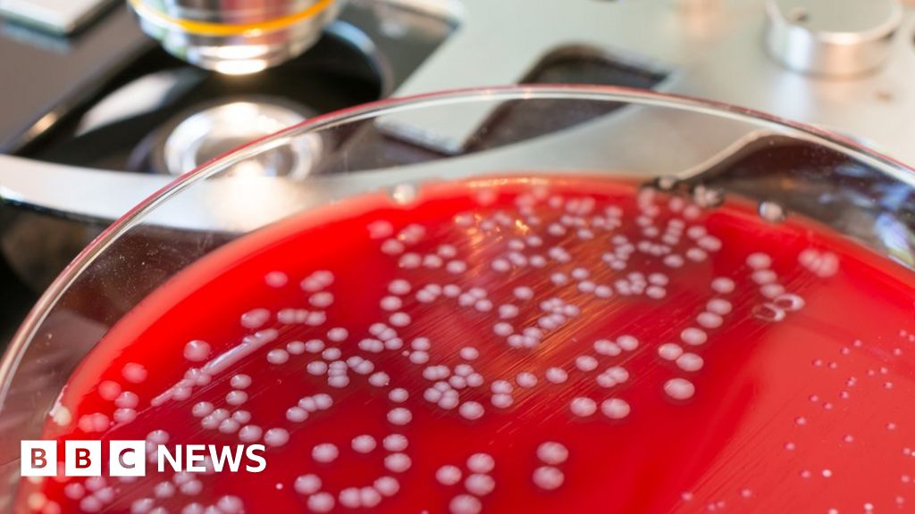 Venison E. coli outbreak numbers reach 11 - BBC News