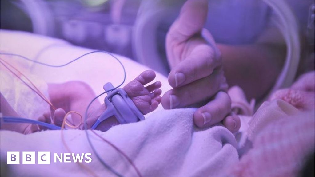 Altnagelvin Hospital: Neonatal intensive care unit reaches capacity