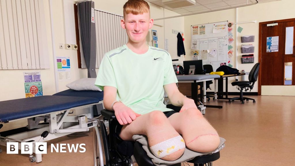 Teen who lost both legs just happy to be alive