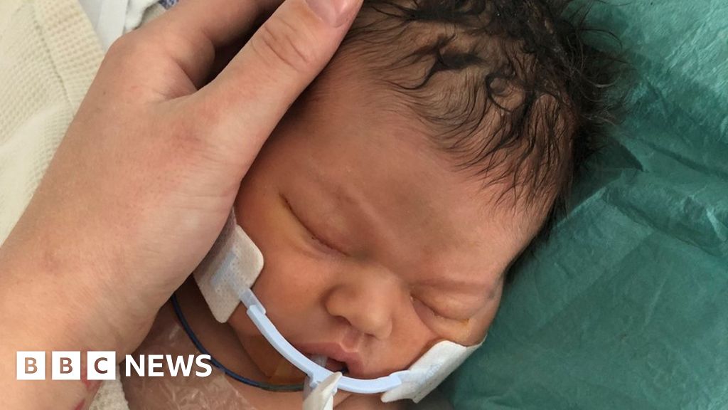 Gloucestershire NHS accepts liability for baby's death