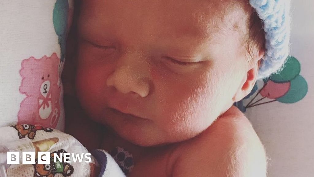 The baby who was 'repaired' in the womb - BBC News
