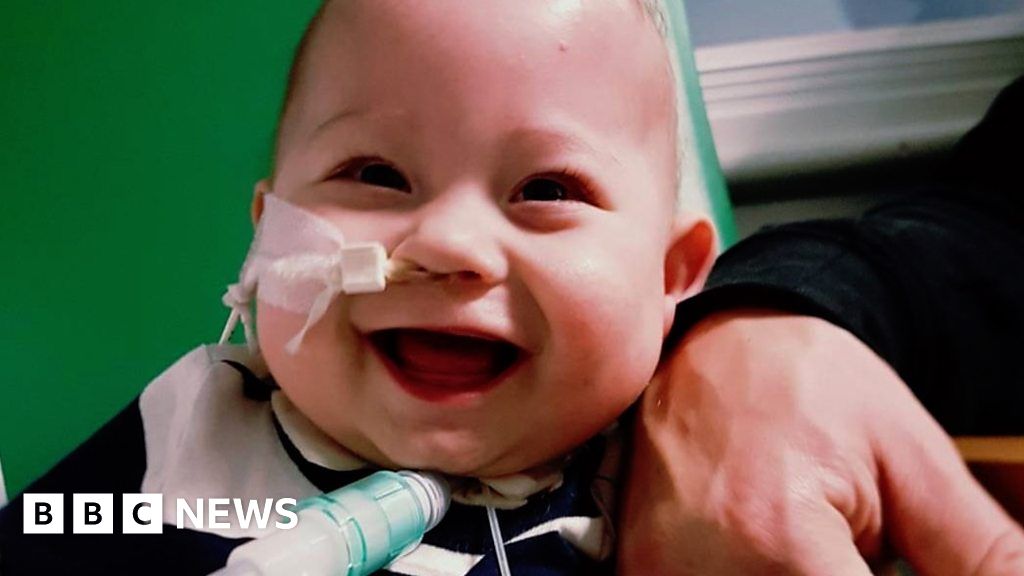 Baby Max spends first year in Southampton hospital - BBC News