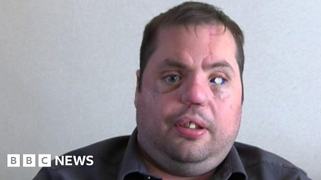 Ex-soldier Simon Brown talks about mental health recovery - BBC News