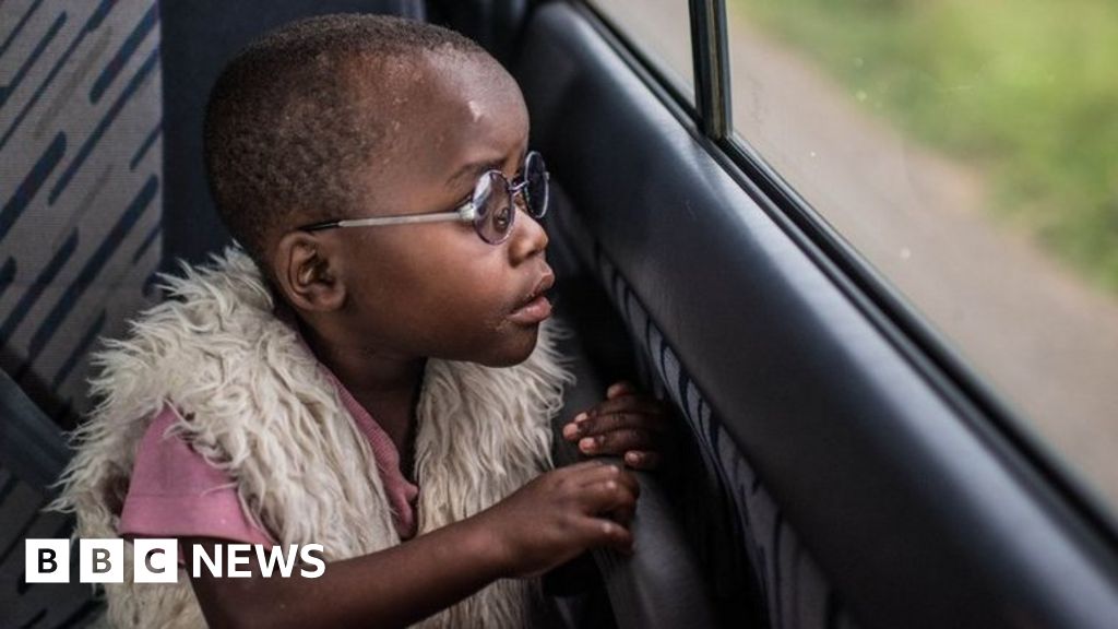 In pictures: Criscent Bwambale sees for the first time in Uganda - BBC News