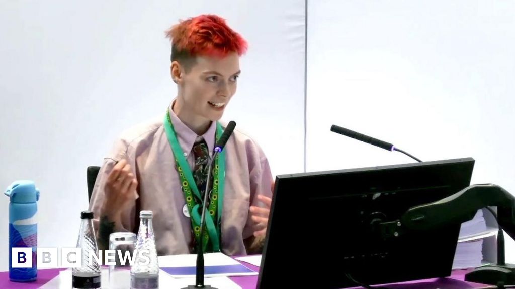 'Possible' misuse of Oxevision monitoring system, trust admits