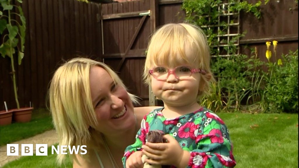 Toddler recovering after lifesaving skull surgery - BBC News
