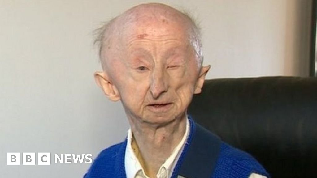 Mugging victim Alan Barnes 'called by God' to Shetland - BBC News
