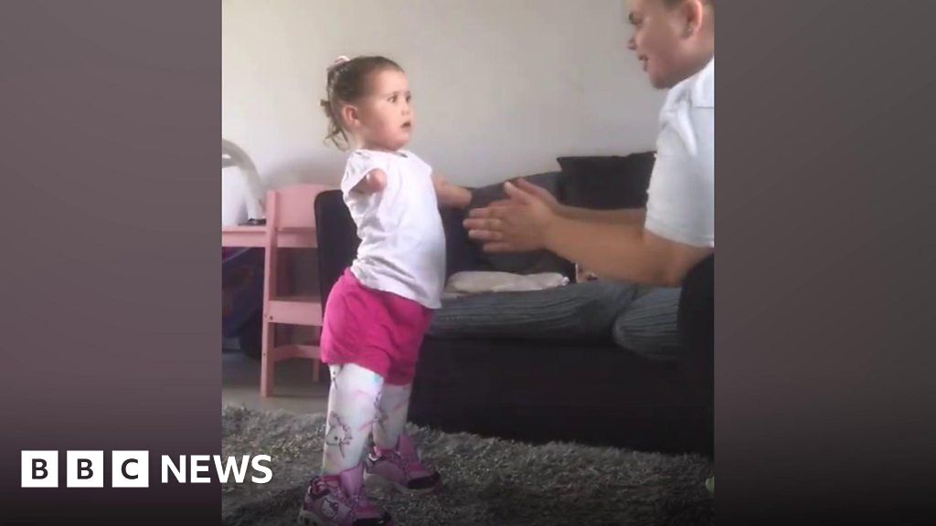 Toddler takes first steps on 'magic' prosthetic legs - BBC News