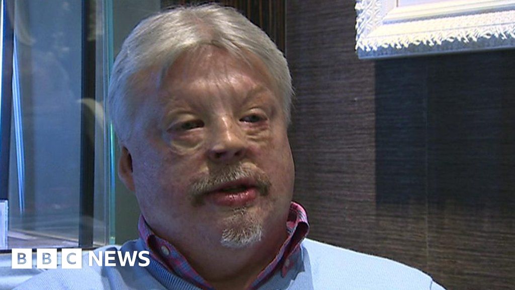 Weston's tribute to 'remarkable' Falklands surgeon - BBC News