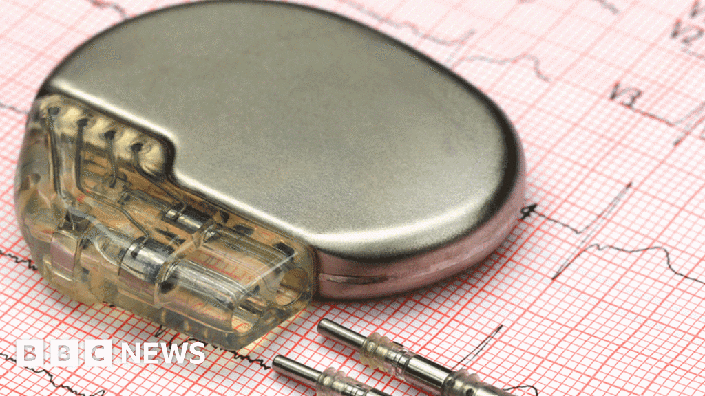 Judge rules pacemaker data admissible in court - BBC News