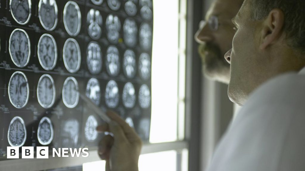 How many minimally conscious patients are there? - BBC News