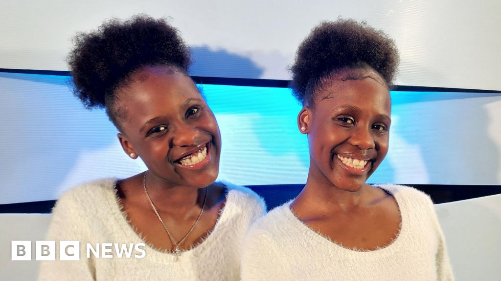 Twins who won The Voice Kids 'will always sing together'