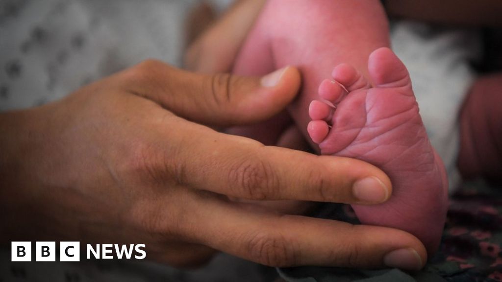 French Ain babies: Missing limb births prompt national inquiry - BBC News