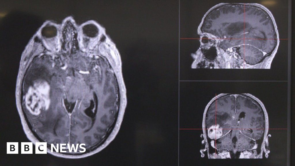 New scan aims to aid tumour detection - BBC News