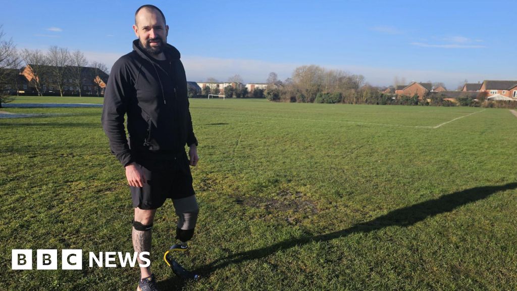 Derbyshire man who asked for leg amputation takes on 10km run