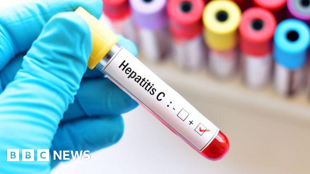 Mobile testing for 'hidden virus' hepatitis C across the region