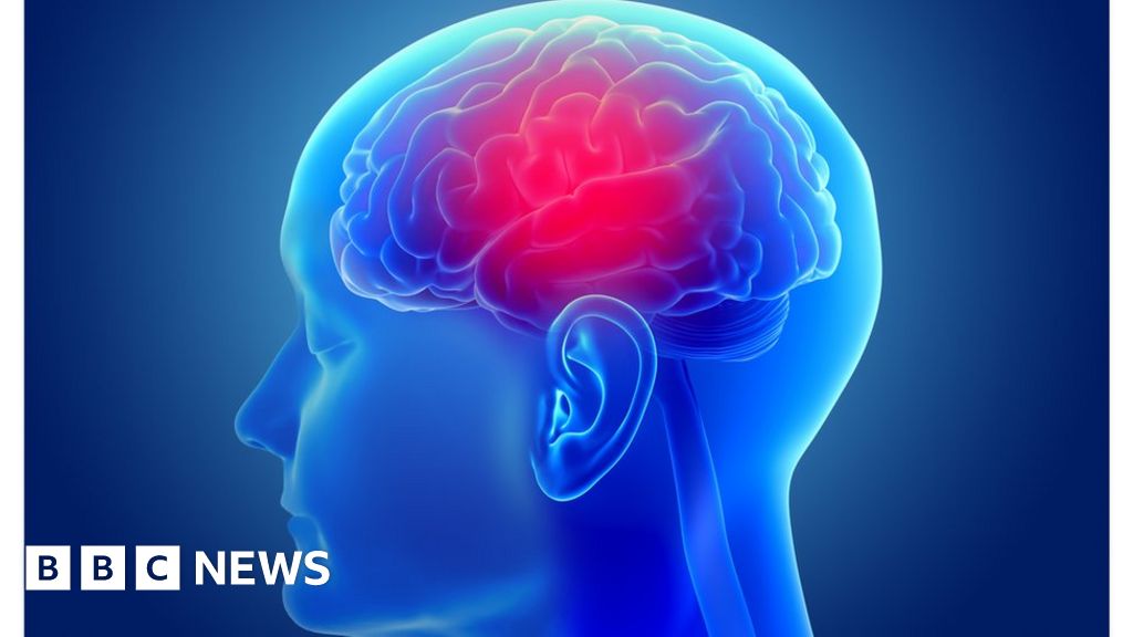 Early brain 'signs of Parkinson's' found - BBC News