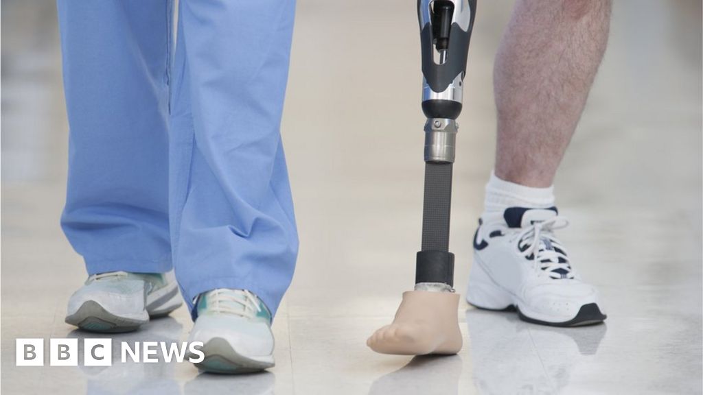Hull: Payout for man who lost leg after Castle Hill treatment delay