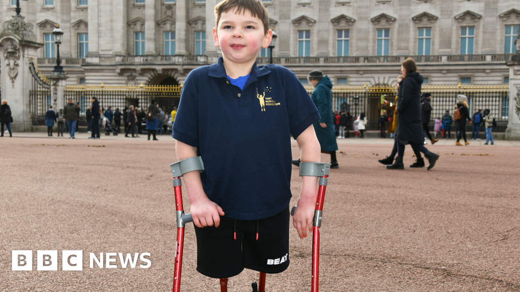 Tony Hudgell: Double-amputee prepares for life-changing surgery - BBC News