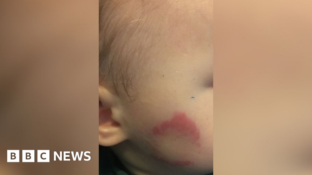 Wellingborough man admits biting toddler's face - BBC News