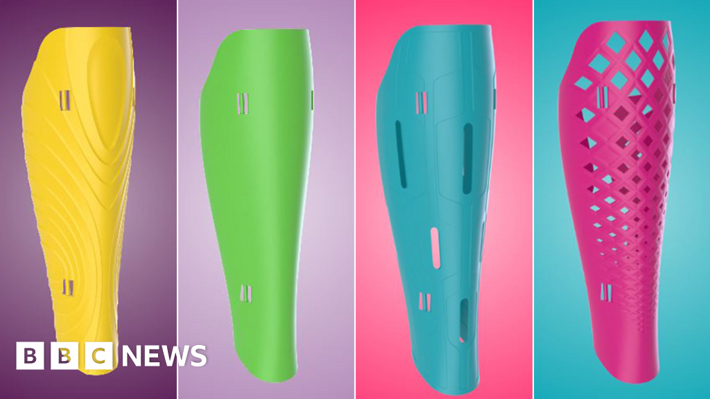 Denbighshire prosthetics firm 'boosts amputees' confidence'