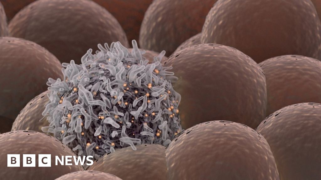 Skin cancer: Half of people surviving advanced melanoma