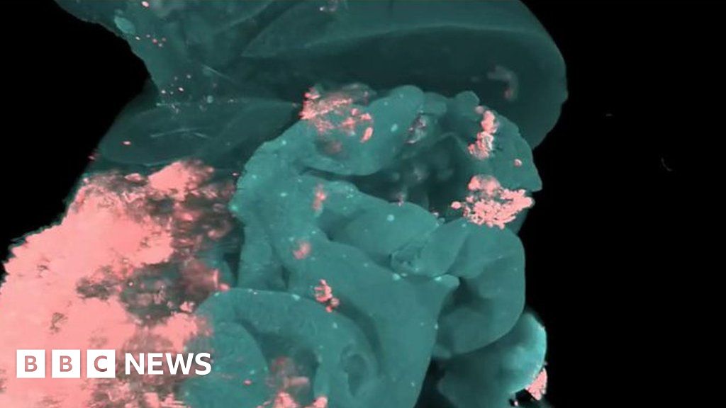 Spreading cancer caught on film - BBC News