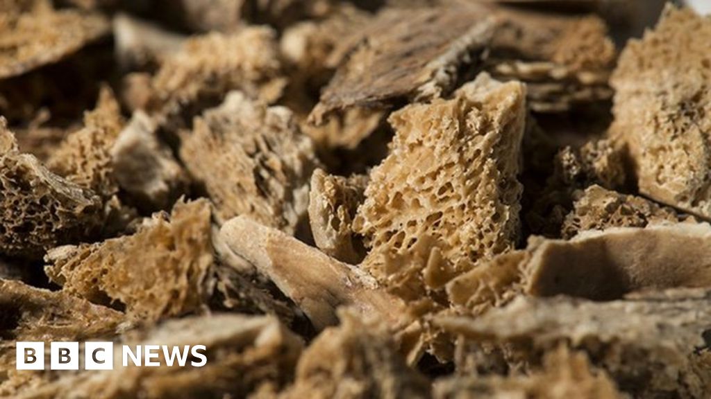 Neutron beam aimed at 'un-burning' bone - BBC News