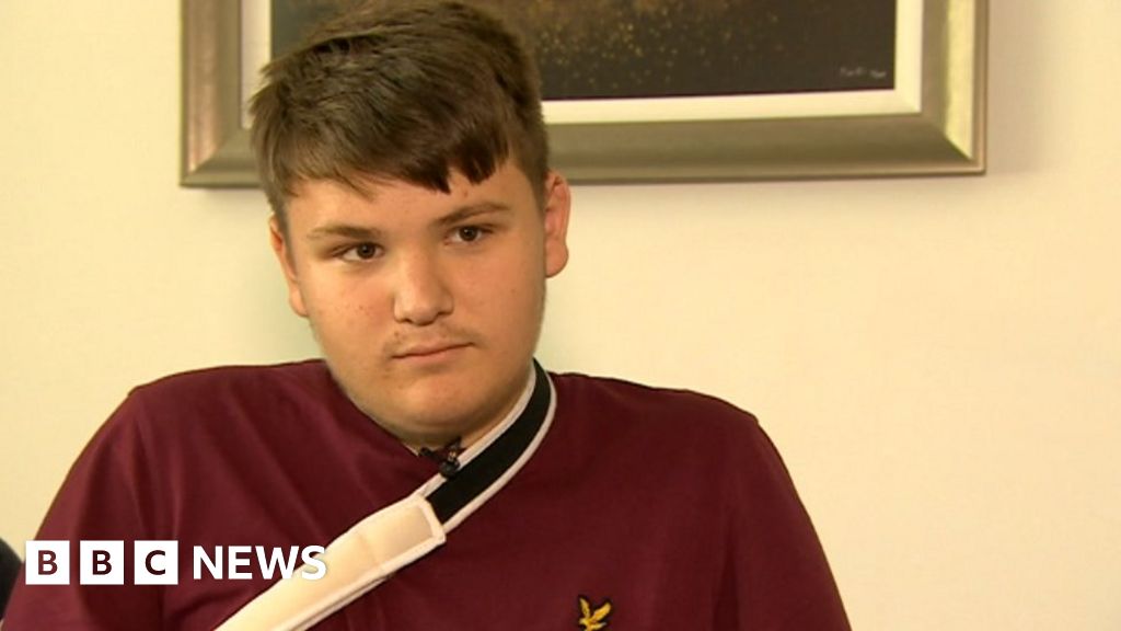 Cannock park attack 'changed boy's life in an instant' - BBC News