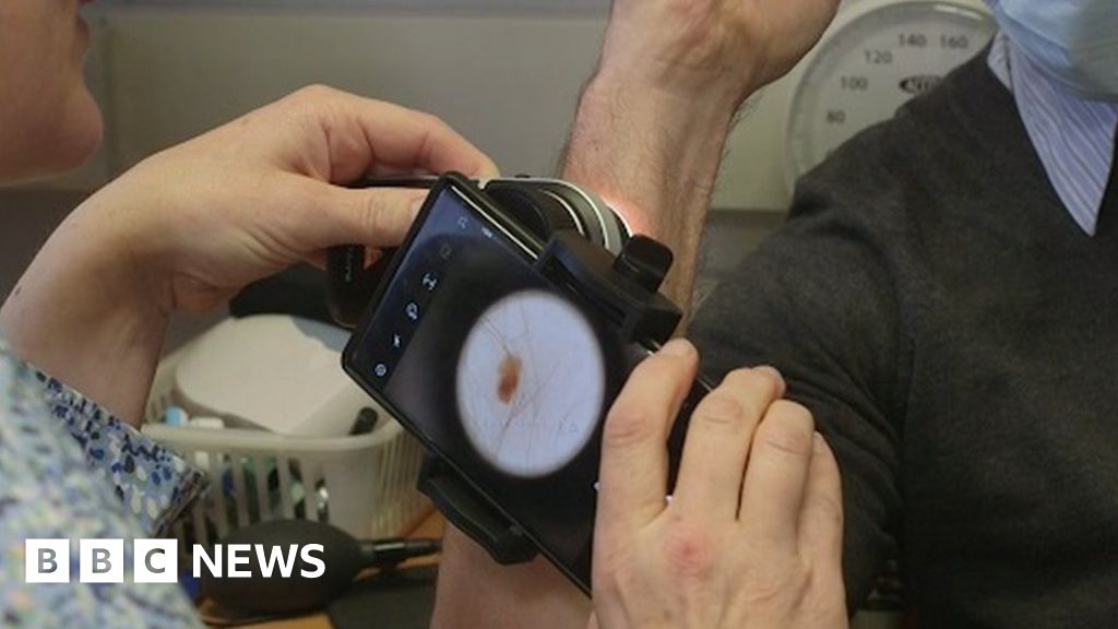 Skin cancer: GPs use app to speed up treatment - BBC News