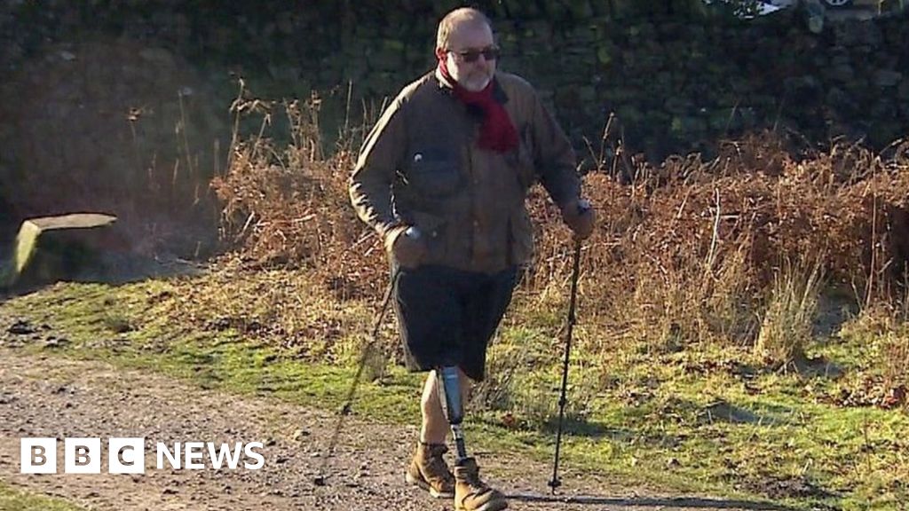 The Leicestershire man with a 'brain' in his knee