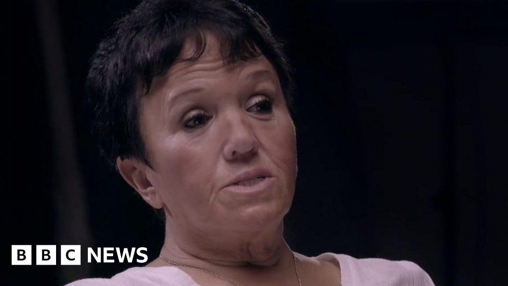 Disability: 'The abuse used to be verbal, now it's physical' - BBC News