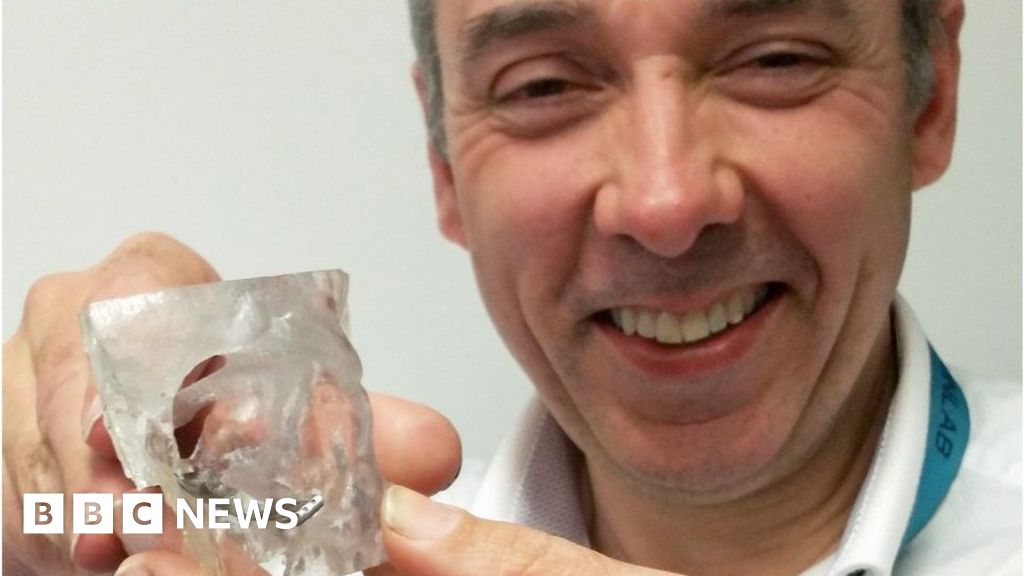 3D printed implants for facial injuries to be made in Wales - BBC News