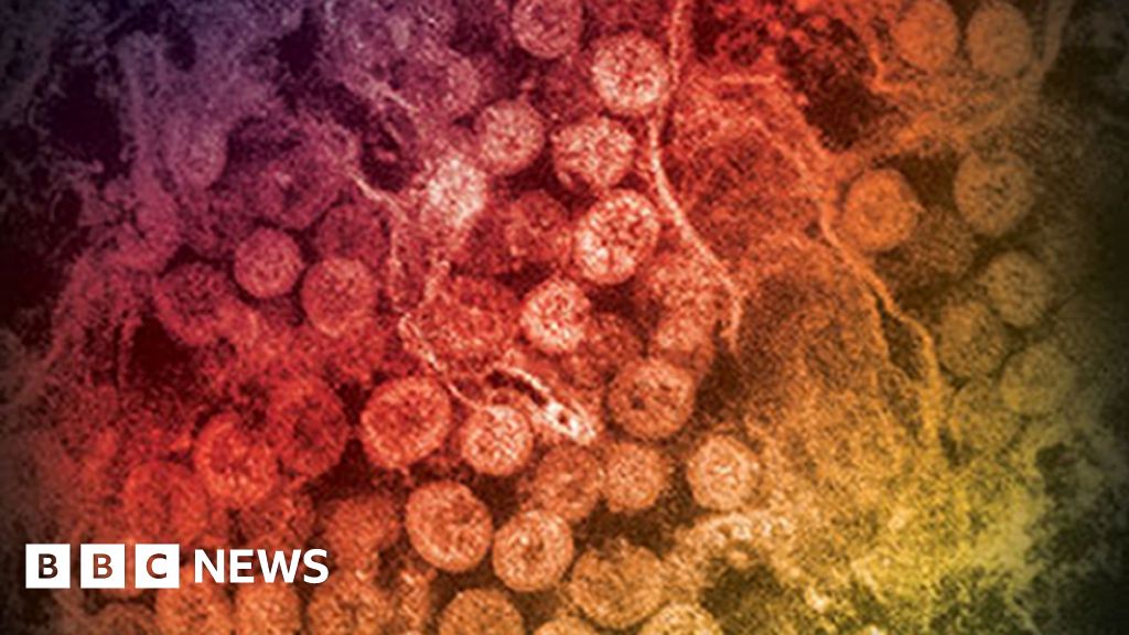 Saudi Arabia sees Mers deaths surge - BBC News