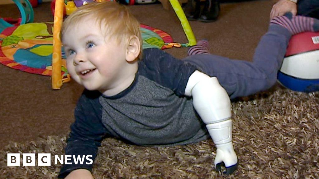 New arm for Anglesey boy - it's child's play - BBC News
