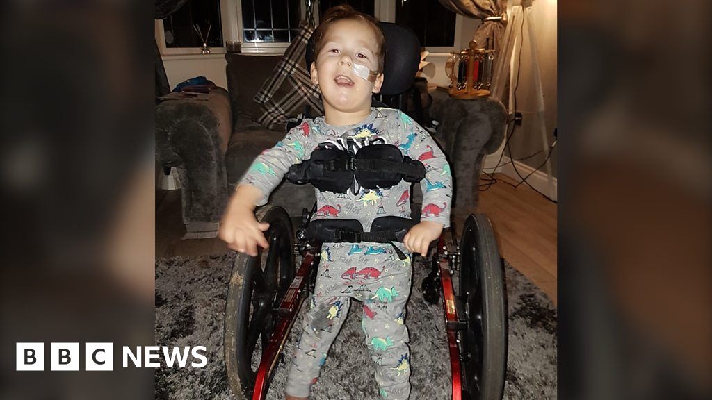 Boy, 4, defies odds to walk for first time